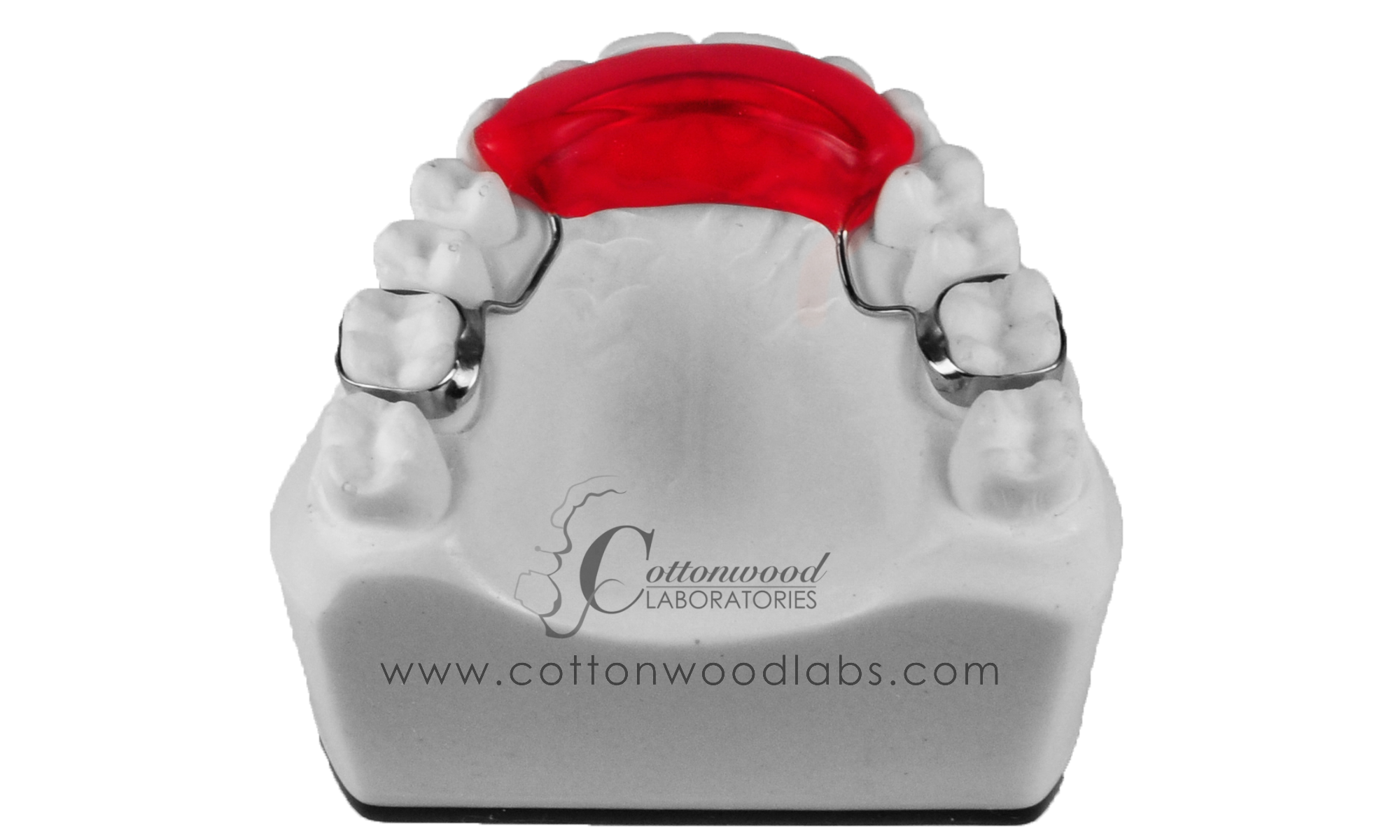 Cottonwood LabsFixed Bite-Plate Anterior Guide - Cottonwood Labs