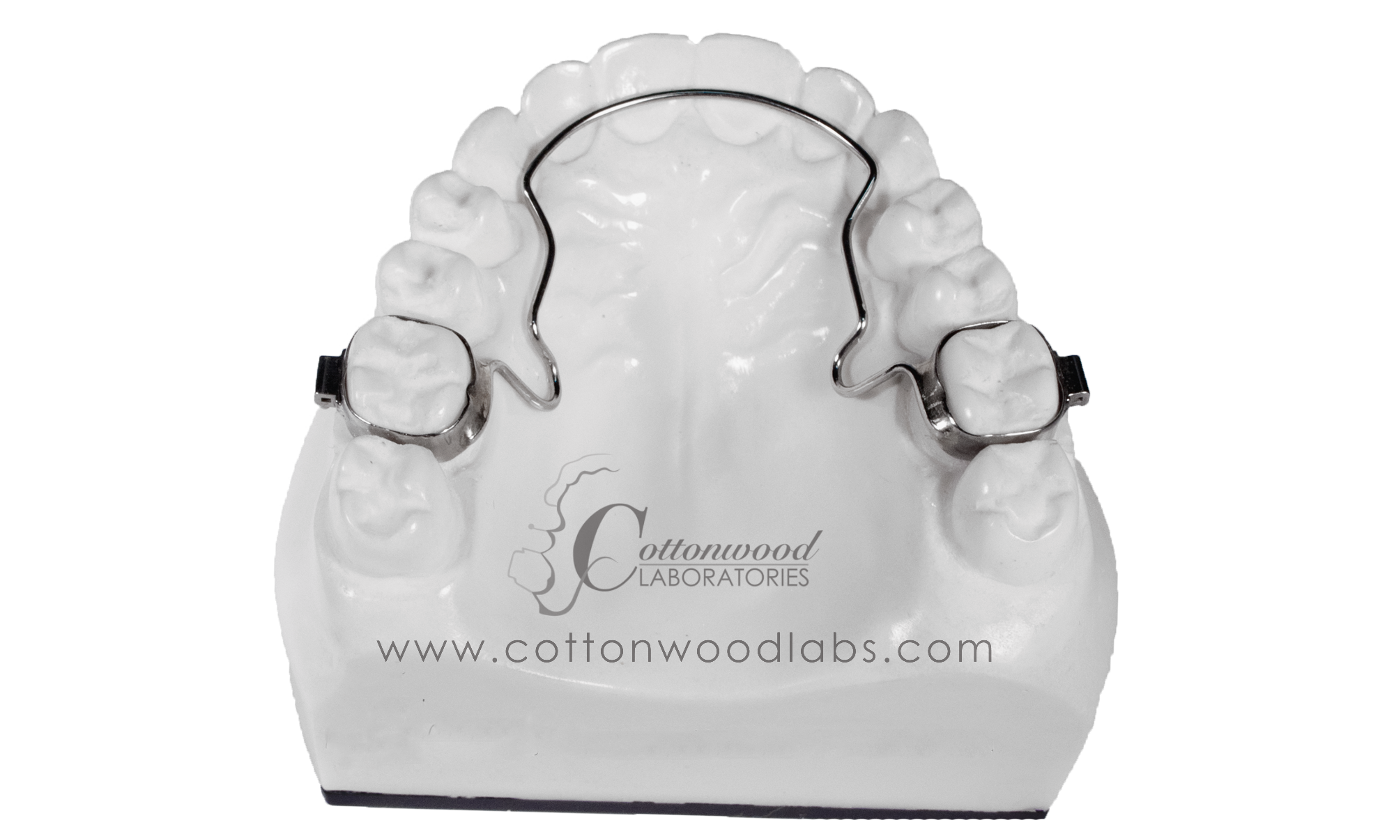 Cottonwood LabsFixed lingual Arch with Loops - Cottonwood Labs