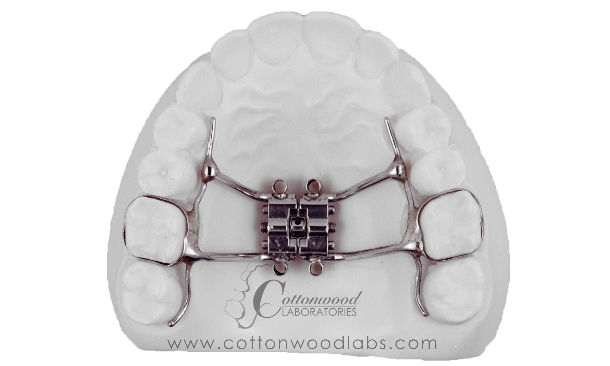 Cottonwood LabsTAD RPE - Cottonwood Labs