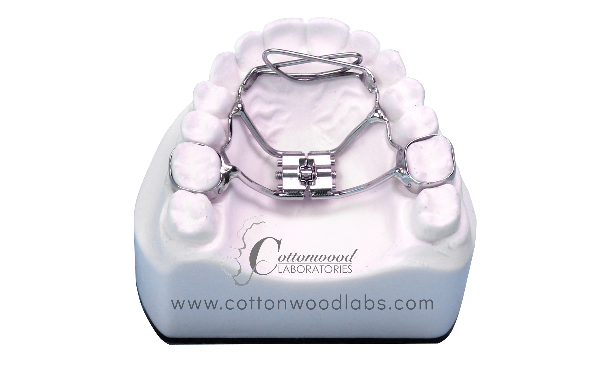 Cottonwood Labsrpe Rapid Palate Expander With Habit Cottonwood Labs